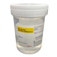 Formalin Vial 120 mL - Vitruvian Health