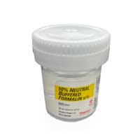 Formalin Vial 20 mL - Vitruvian Health