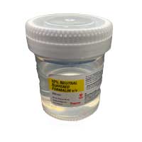 Formalin Vial 60 mL - Vitruvian Health